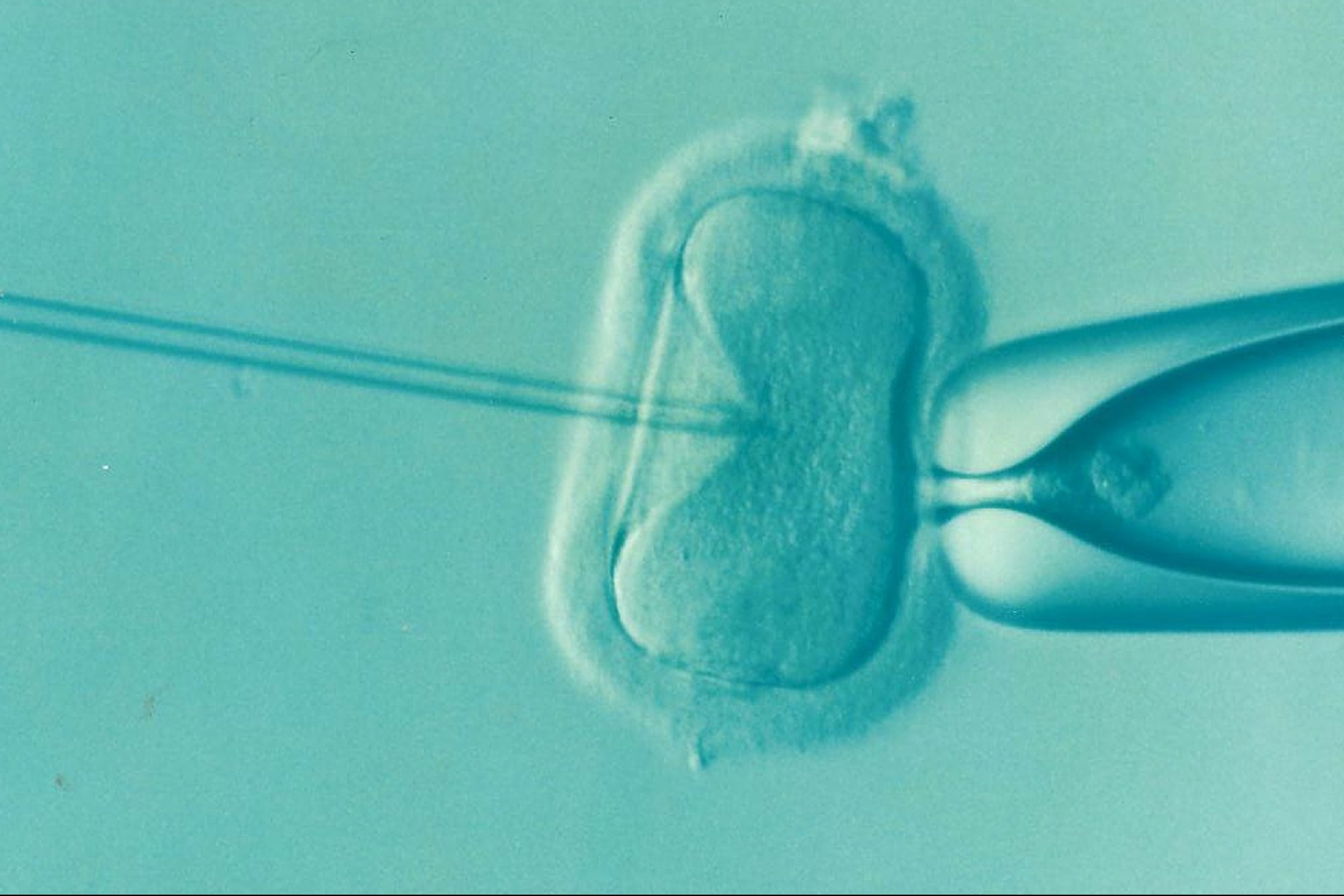 How IVF Treatment Brings in Fertility, Pregnancy and Motherhood ...