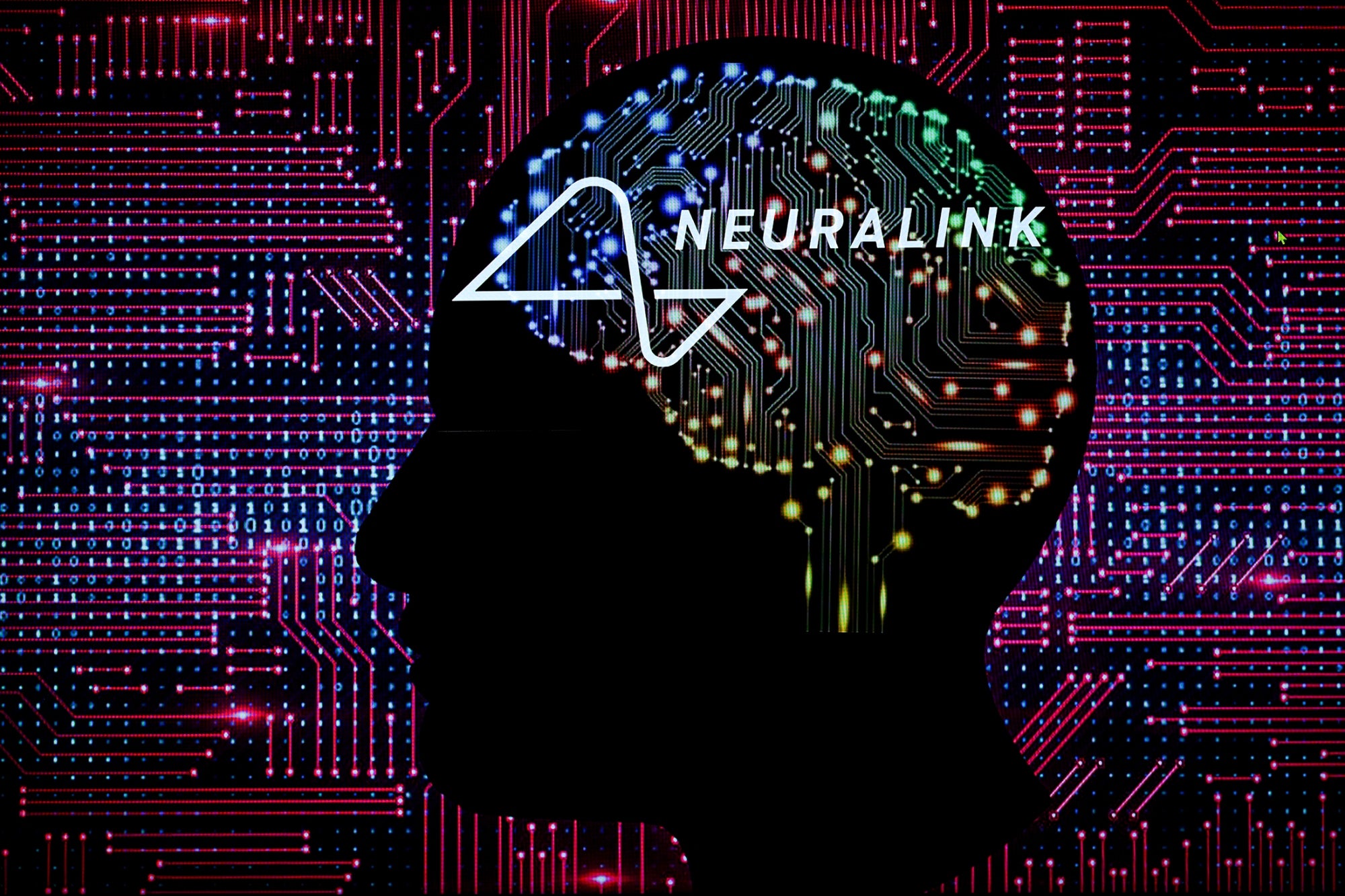 Neuralink inicia con el reclutamiento de personas para probar sus ...