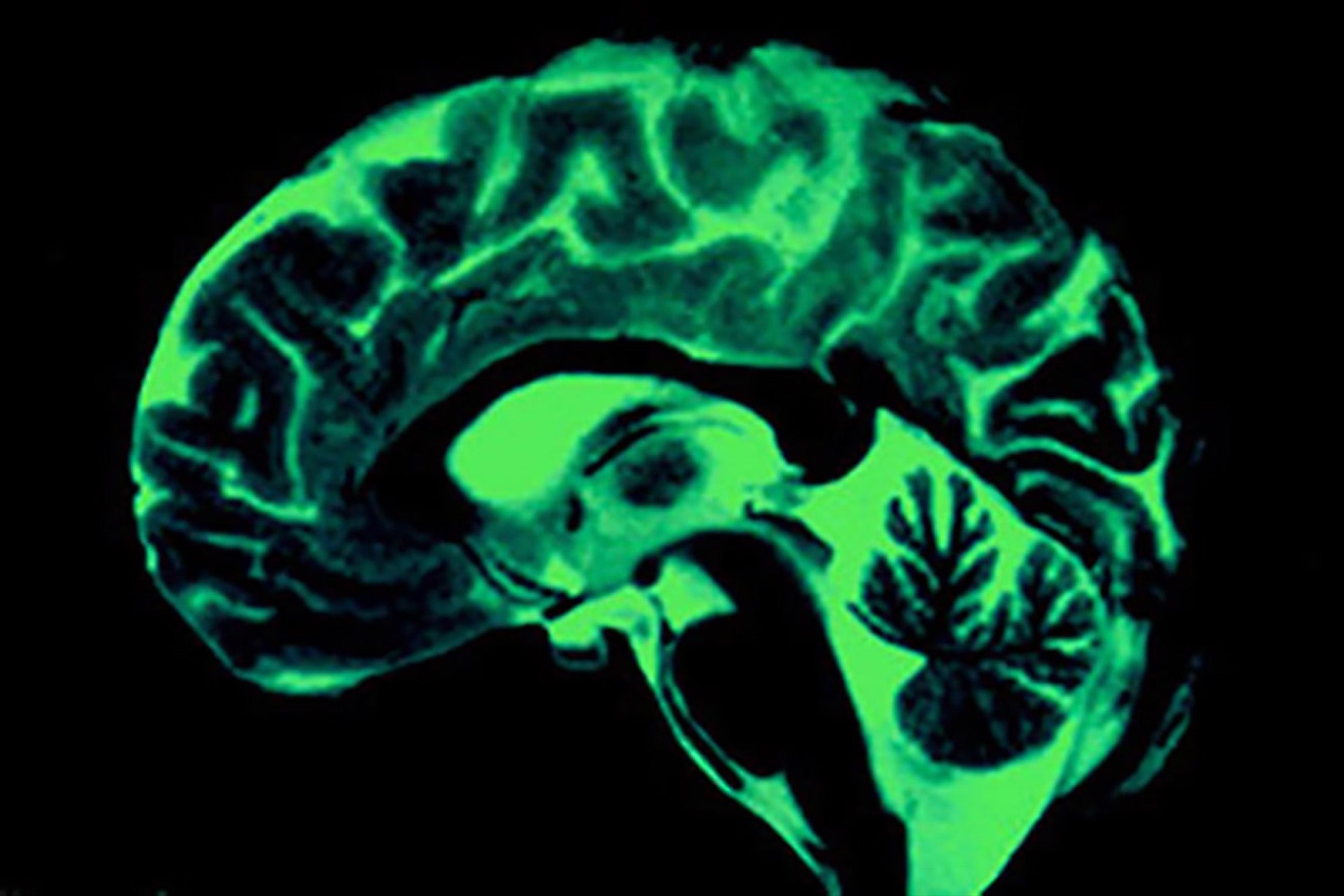 This Is Your Brain on Fear (Infographic) | Entrepreneur